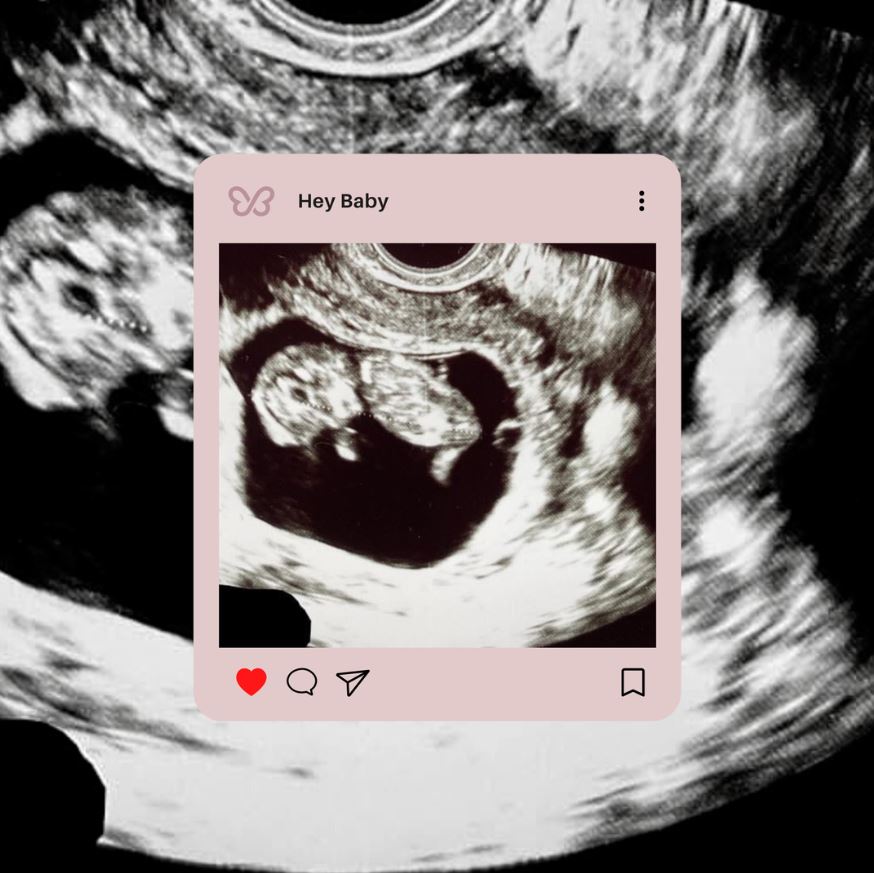 Understanding the Surrogacy Process for Intended Parents – SurrogateFirst