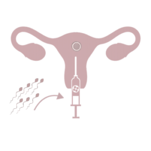 What is surrogacy? - SurrogateFirst